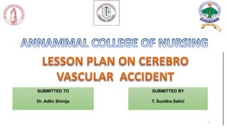 Medical surgical Lesson plan.pptx
