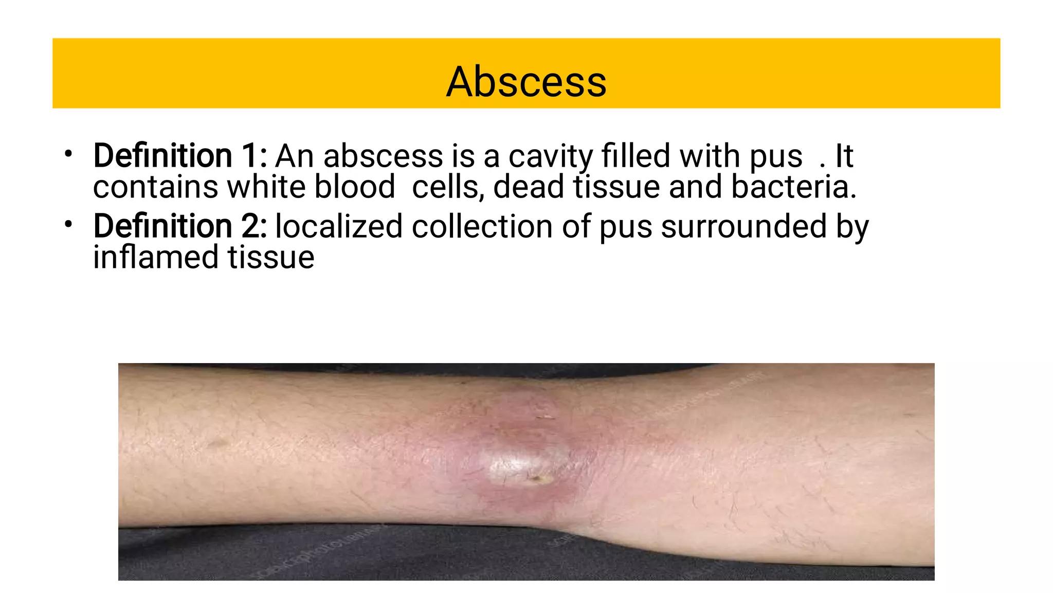 MEDICAL SURGICAL NURSING 1-1.pdf