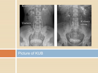 Medical terminology Chpt 9H Urinary System Abbrv | PPTX