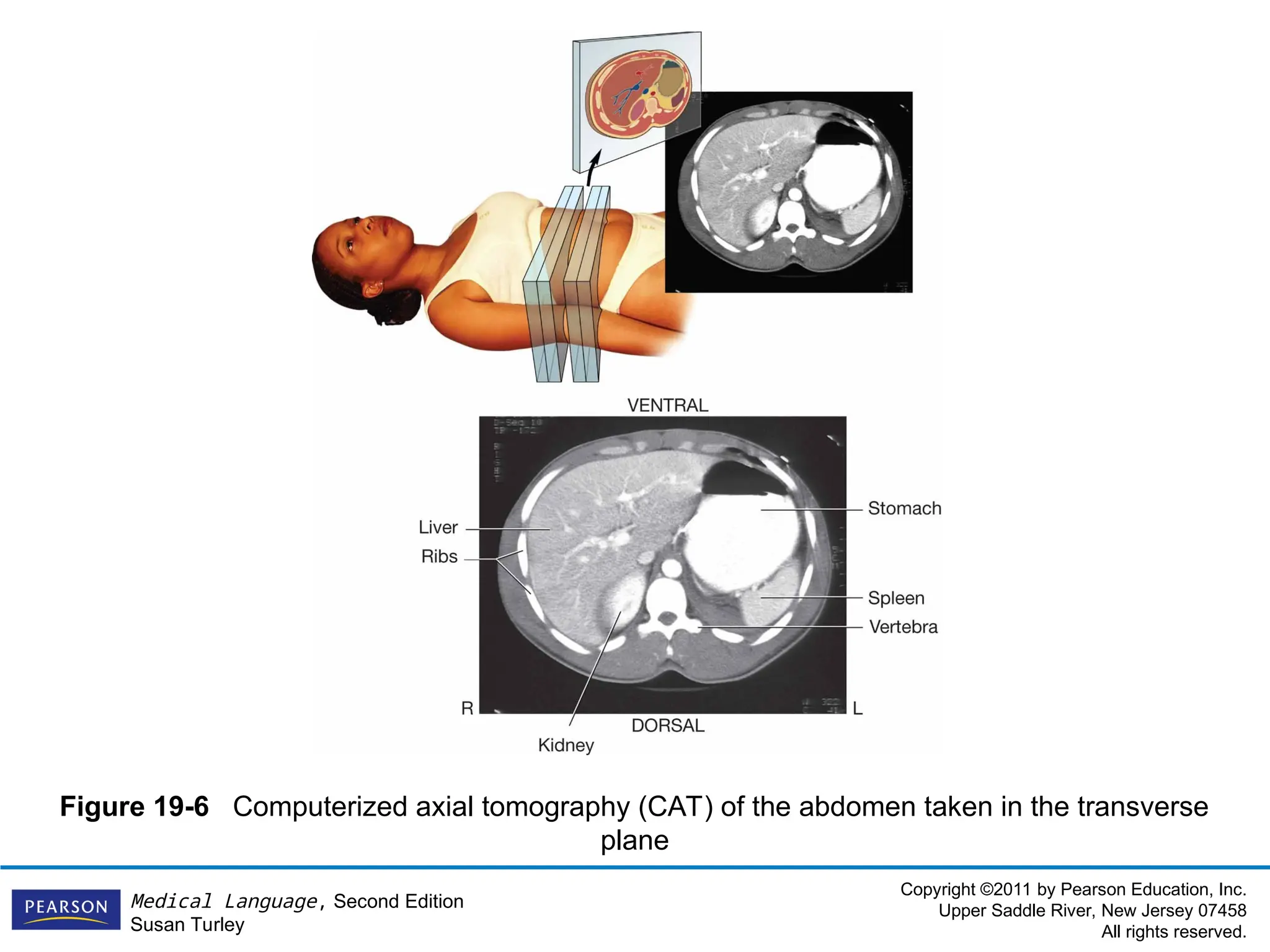 Medical Terminology 19.ppt and radiology | PPT