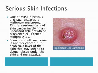 Medical terminology – Chapter 3B Skin | PPTX