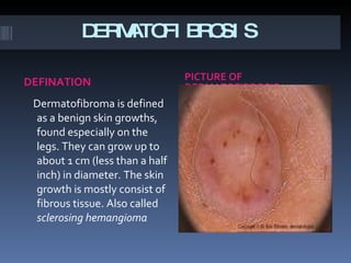 Medical Term Presentation 2 | PPT | Skin and Dermatology | Diseases and ...