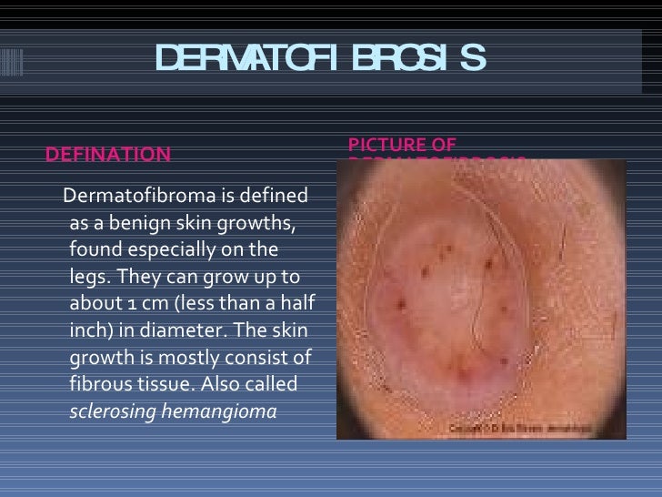 Medical Term Presentation 2