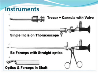 Medical Thoracoscopy | PPT