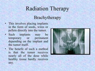 Medical Uses of Ionizing Radiation an.ppt