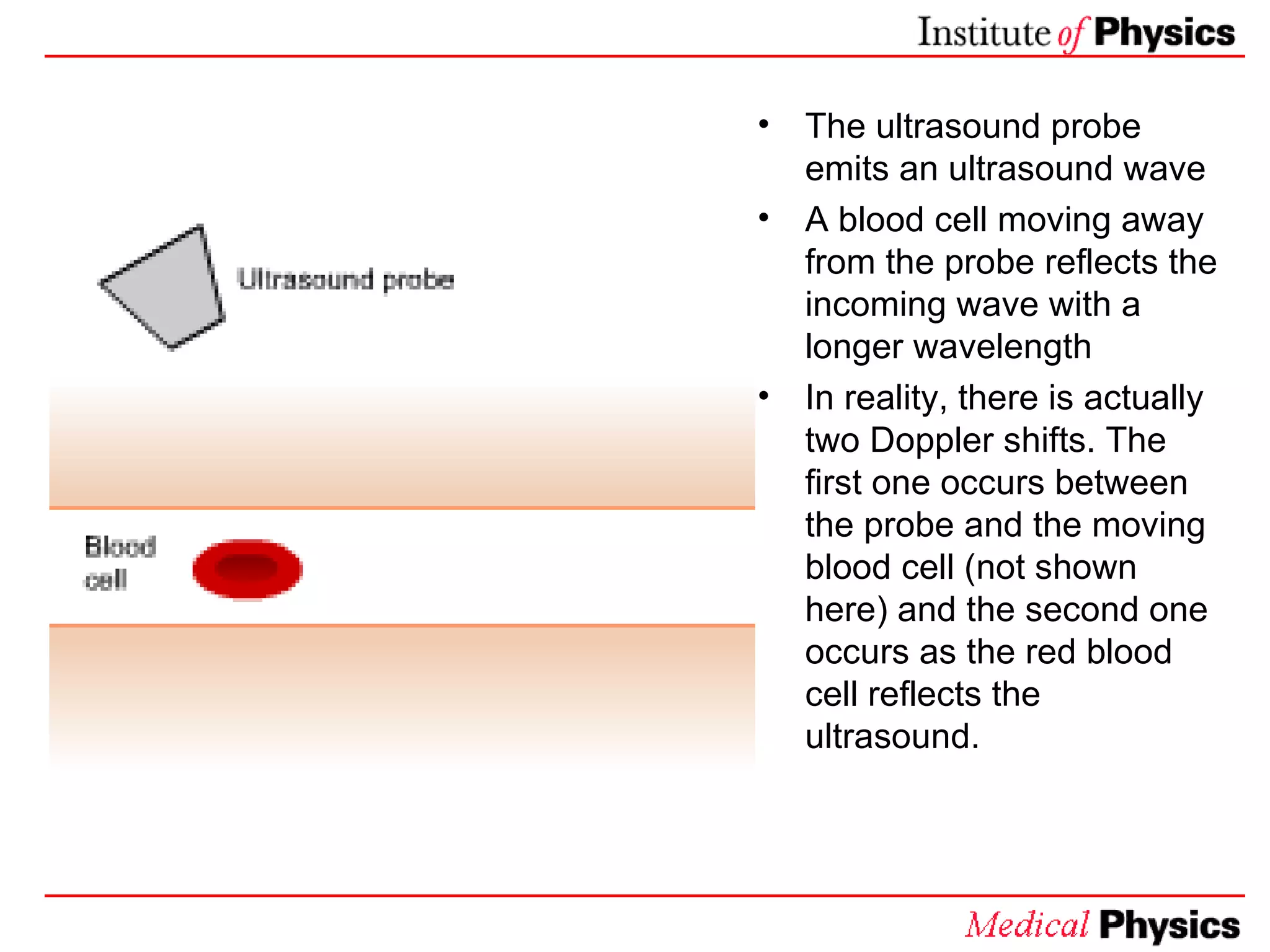 Medical Uses Of Ultrasound | PPT