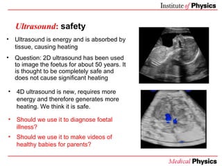 Medical Uses Of Ultrasound | PPT