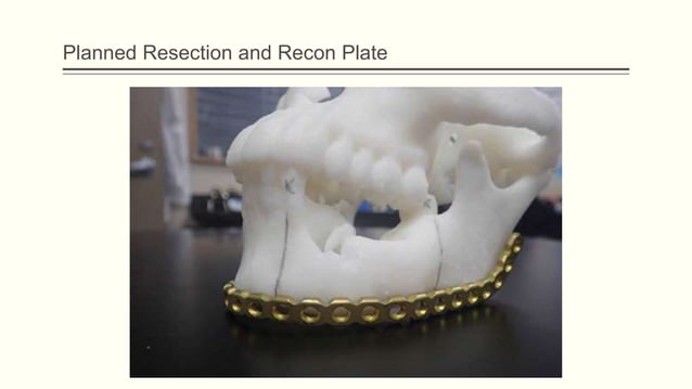 Medication-Related Osteonecrosis of the jaws (MRONJ).pptx