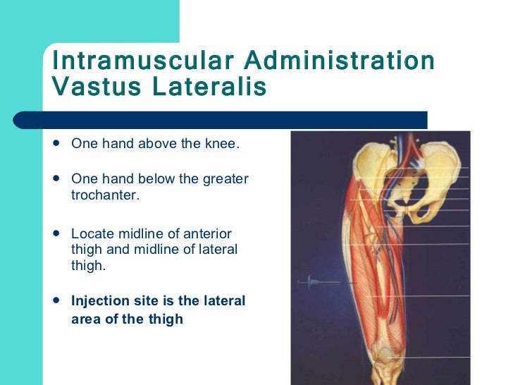 Medication administration