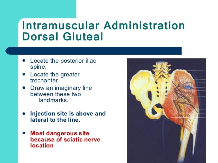 Medication administration