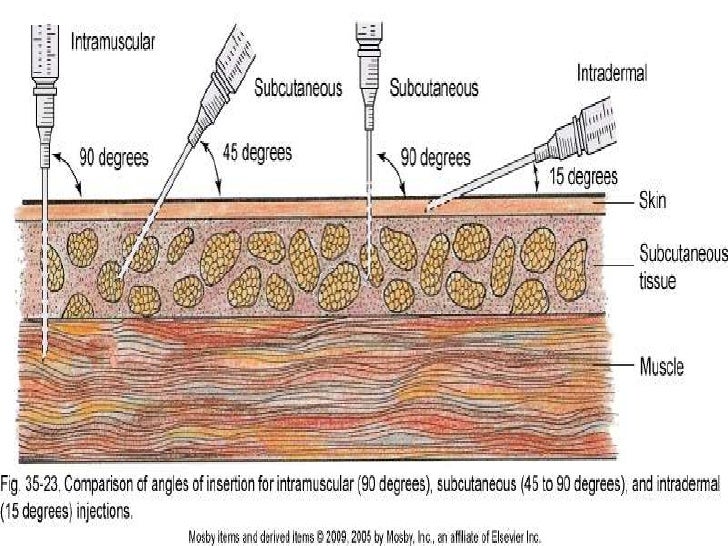 Medication administration