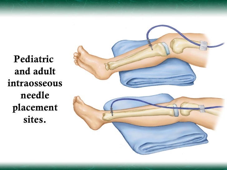 Medication administration part 2