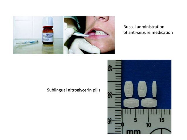Medication administration via the gastrointestinal (gi) | PPT