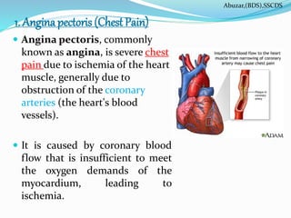 Medications in Angina | PPTX