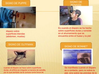 Medicina Legal Universidad Fermin Toro | PPTX