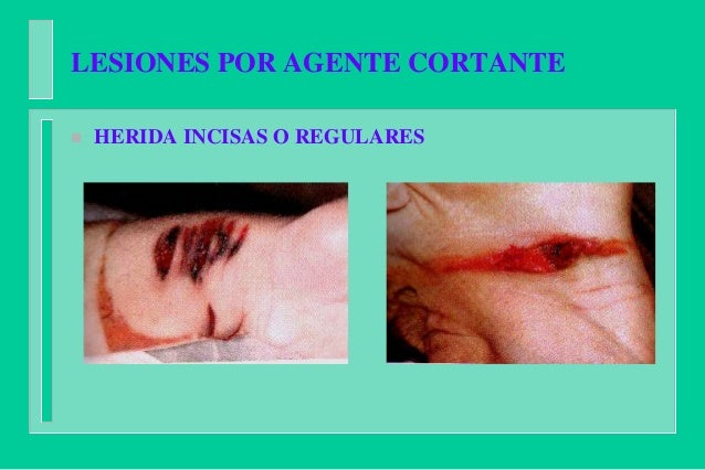 Medicina forense. lesiones en general