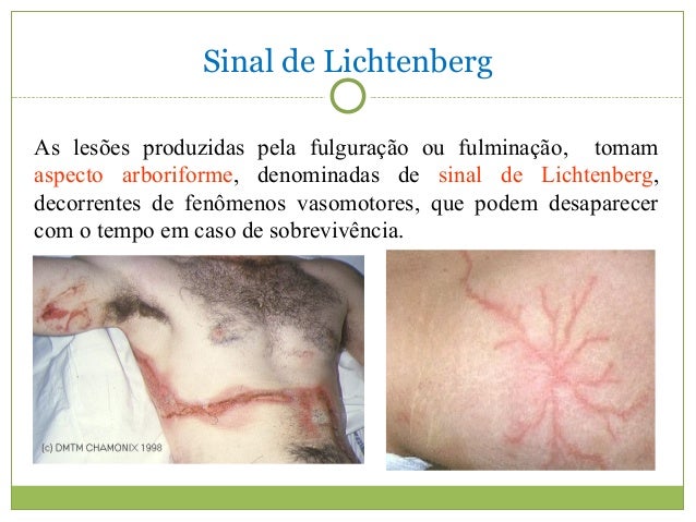 Medicina forense usp traumatologia médico-legal