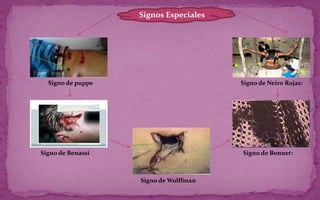 Medicina legal | PPTX