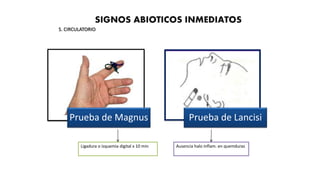 TANATOLOGIA MEDICINA LEGAL MUERTE FENOMENOS CADAVERICOS | PPTX
