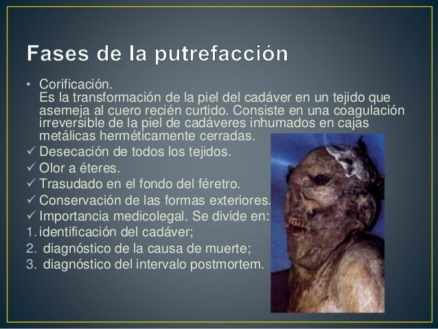 Evolución del cadáver
