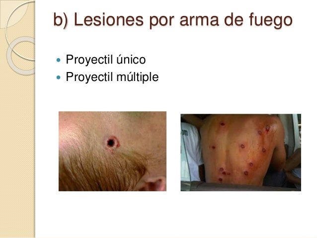 Clasificación legal de las lesiones