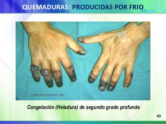 Medicina Legal Traumatologica