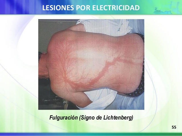 Medicina Legal Traumatologica