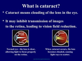 Medicinal plants - the future in cataract therapy | PPT