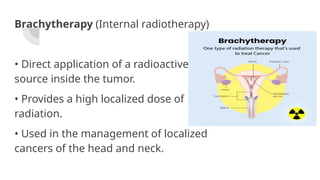 Indications for surgery and Radiation therapy for common malignancies ...