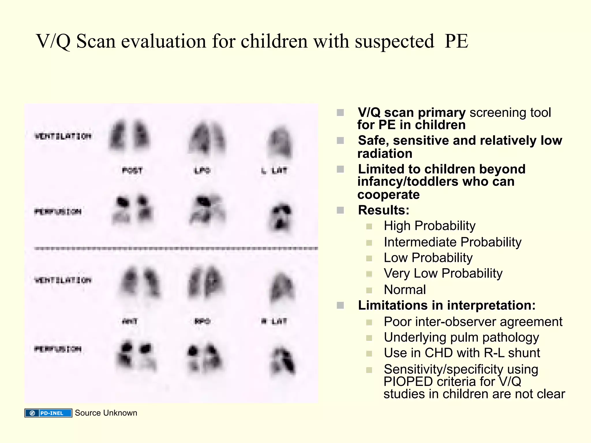 GEMC: Acute Pulmonary Emergencies: Pulmonary Embolism, Pulmonary Edema ...