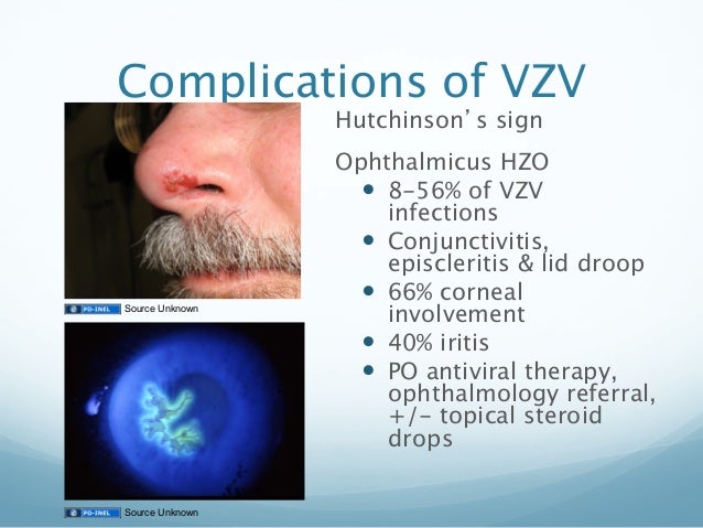 GEMC- Case of the Week #2- for Residents