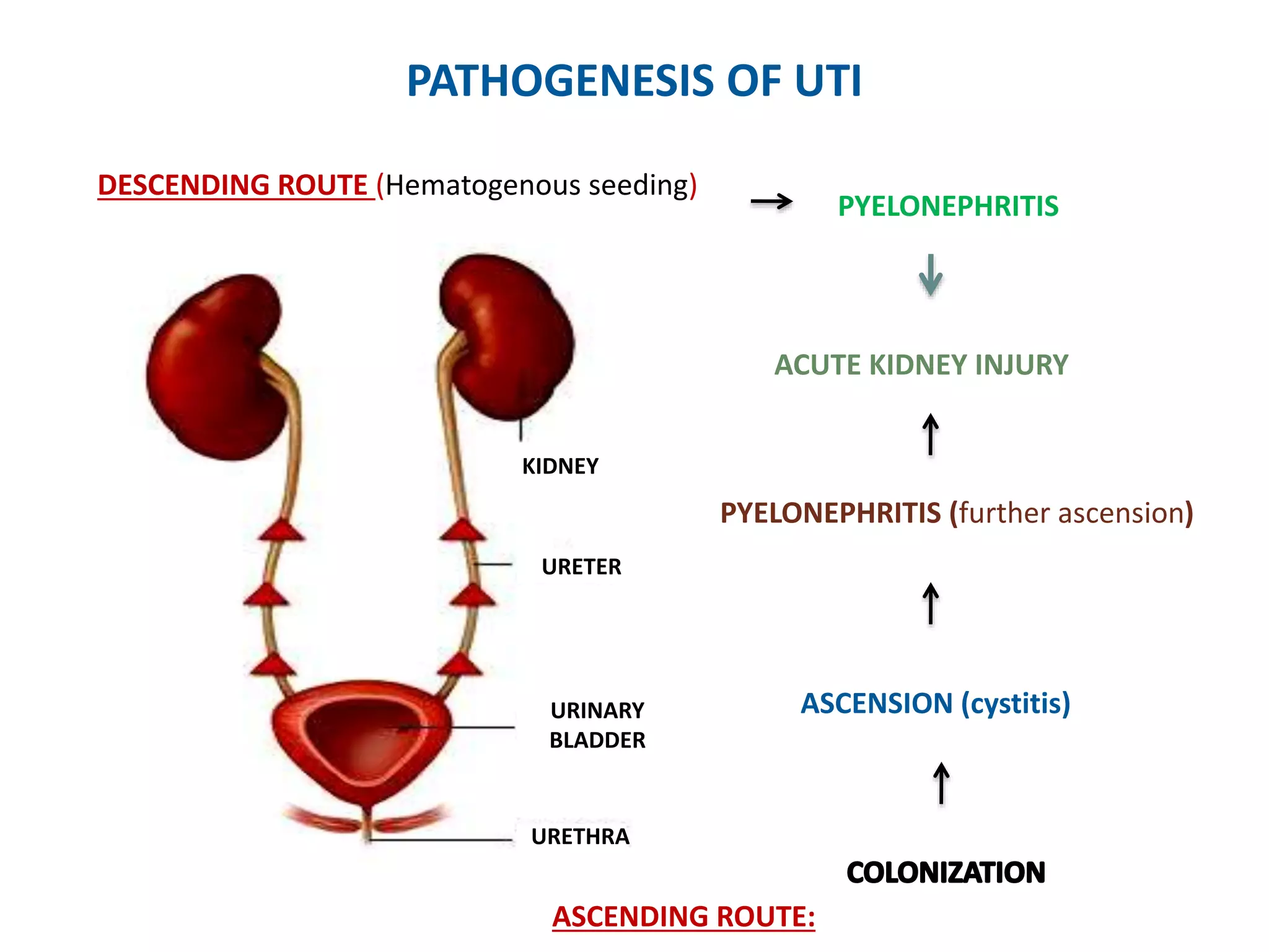 URINARY TRACT INFECTION | PPTX