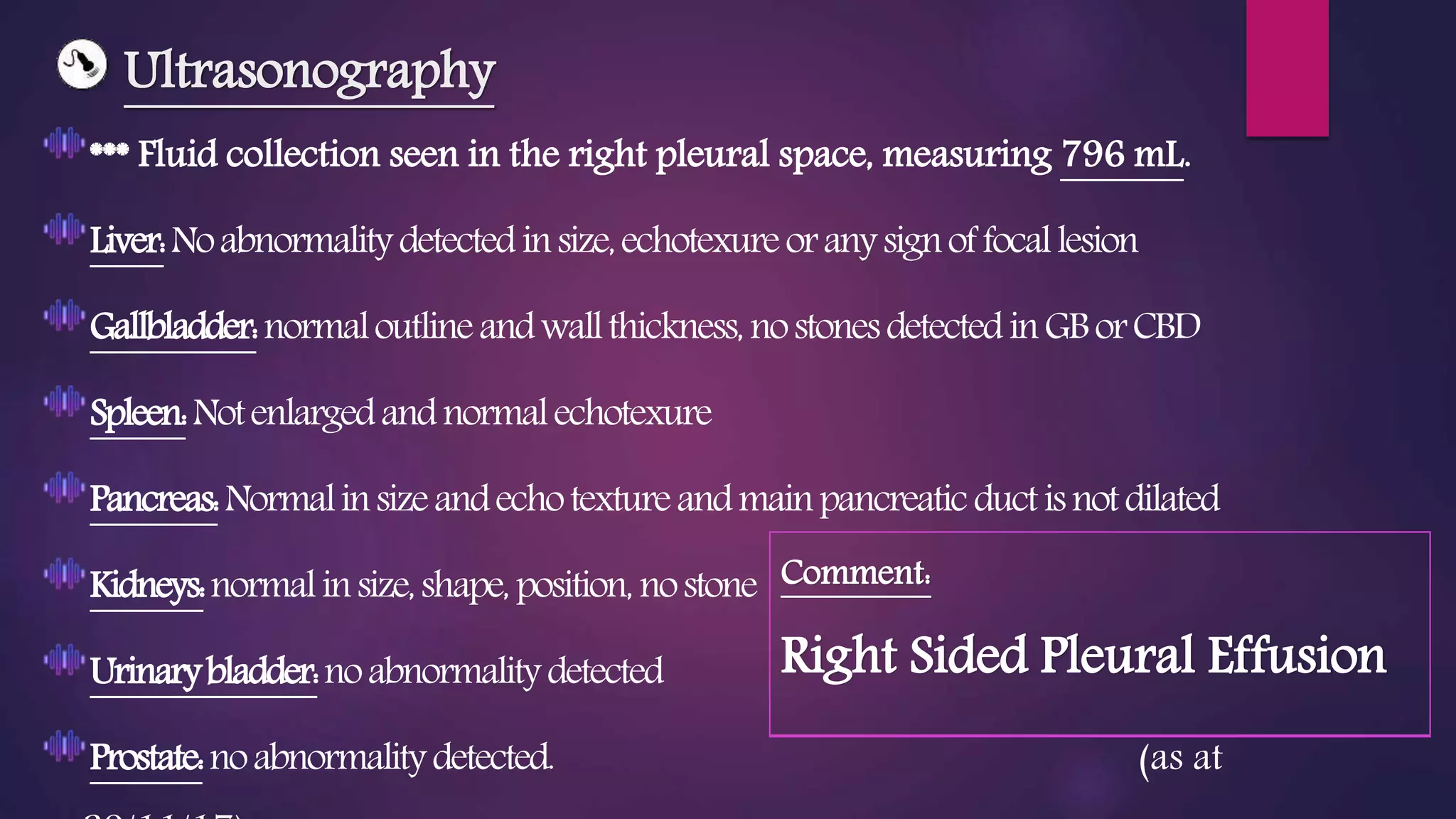 Pleural effusion | PPTX