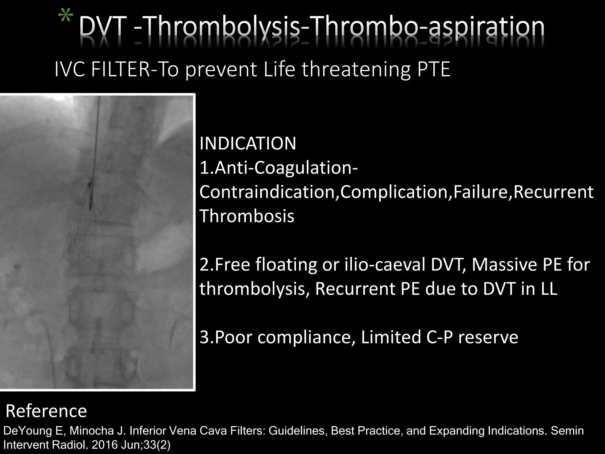 Vascular & Interventional Radiology | PPTX