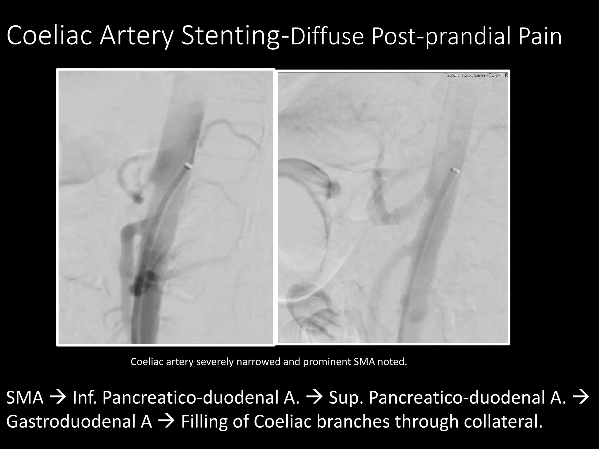 Vascular & Interventional Radiology | PPTX