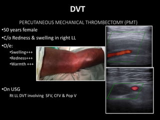 Vascular & Interventional Radiology | PPTX