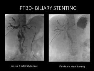 Vascular & Interventional Radiology | PPTX