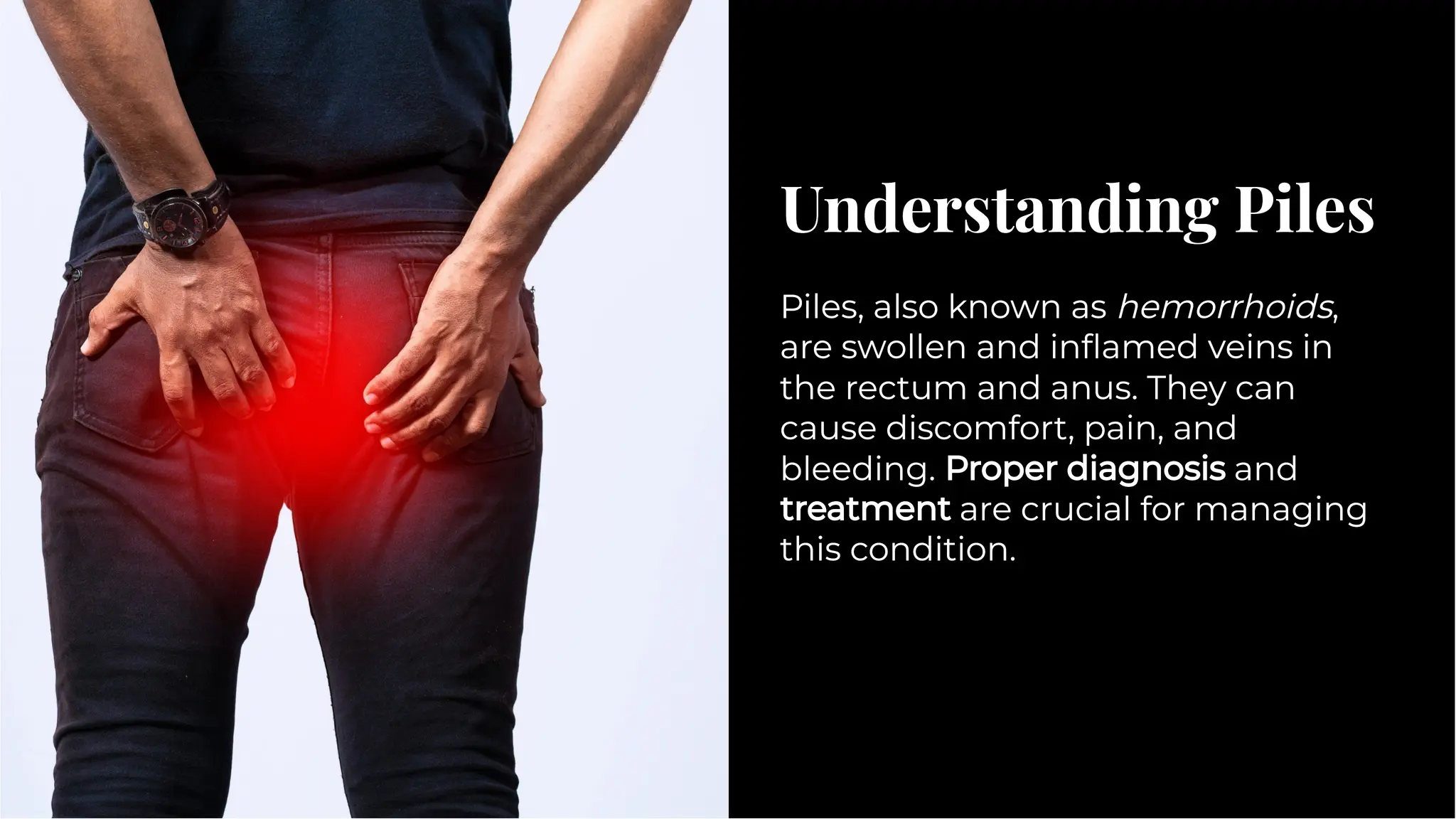 Trustworthy Medicines for Piles cure.pdf