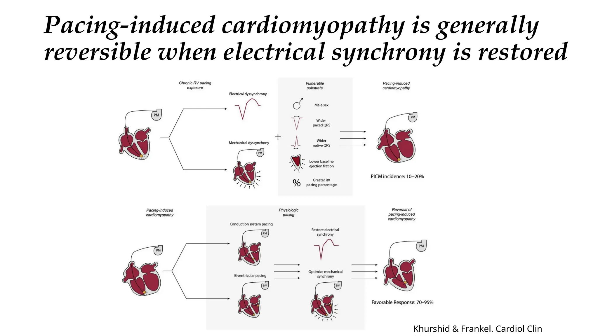 Review of conduction system pacing | PPTX