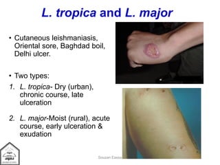 BLOOD AND TISSUES FLAGELLATES/ HAEMOFLAGELLATES OF HUMAN BEINGS | PDF