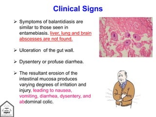PHYLUM CILIOPHORA Balantidium coli | PDF