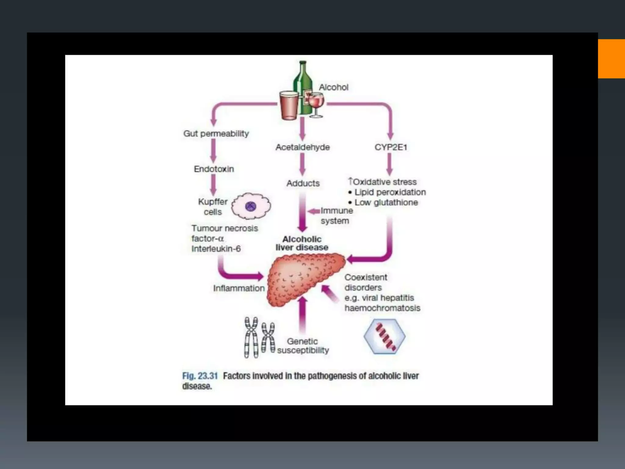 chronic liver disease (CLD) | PPTX