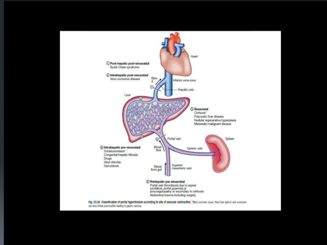 chronic liver disease (CLD) | PPTX