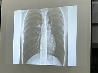 medicine x ray, data, prob (final)(1).pdf