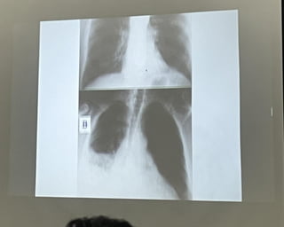 medicine x ray, data, prob (final)(1).pdf