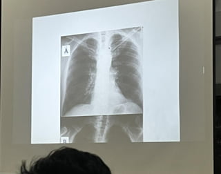 medicine x ray, data, prob (final)(1).pdf