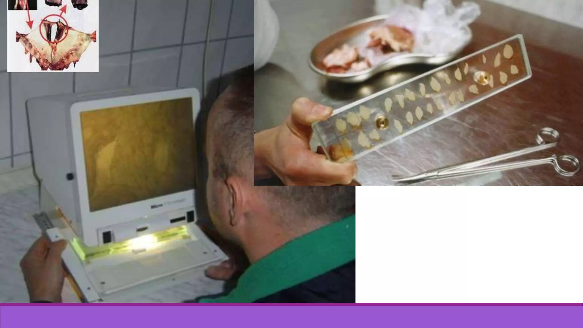 Medicinska parazitologija | PPSX