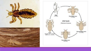 Medicinska parazitologija | PPSX