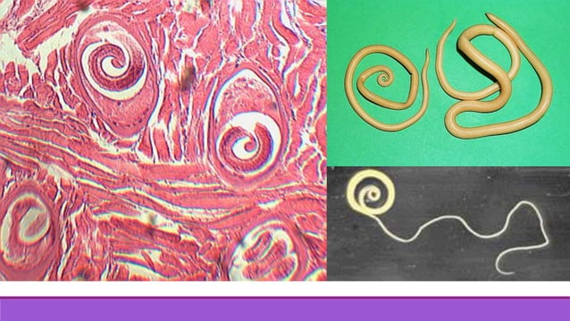 Medicinska parazitologija | PPSX