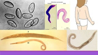 Medicinska parazitologija | PPSX